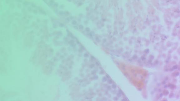 Gallery | AB7: ECLIPSE